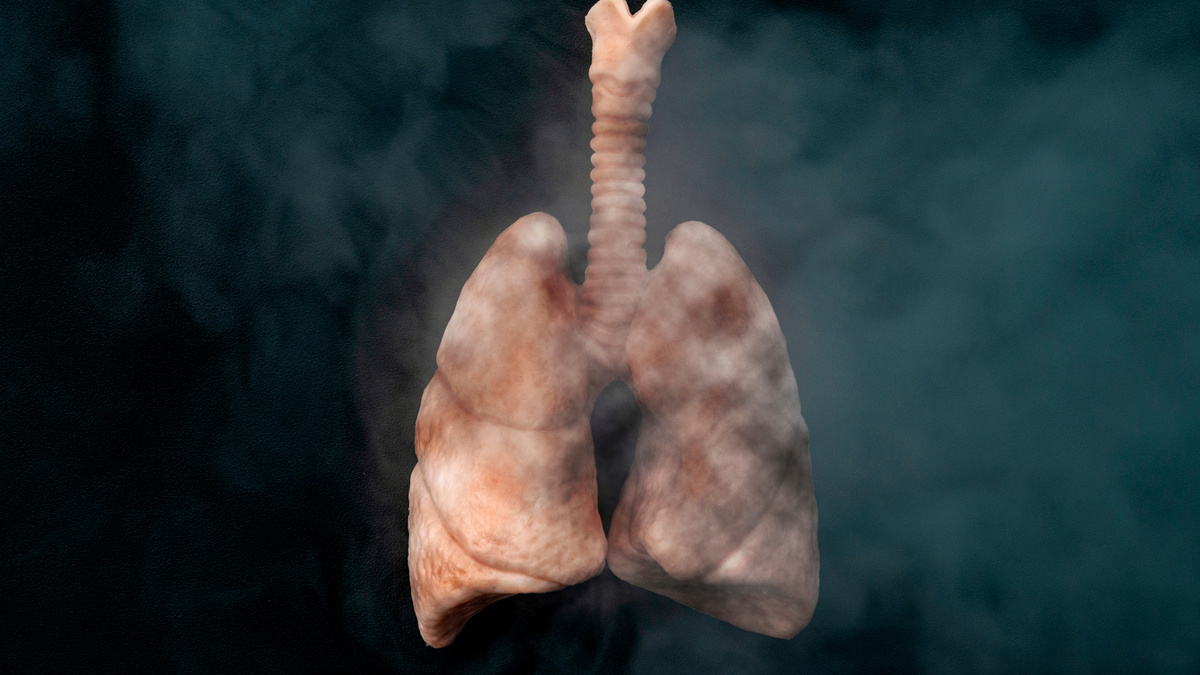 How to Reduce Tar in Cigarettes | NicoBloc | NicoBloc